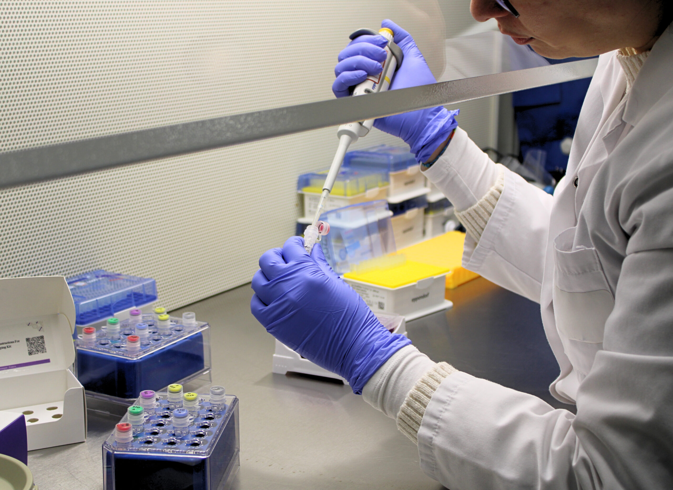 Neurodegenerative disease diagnostic tools | Amoneta Diagnostics